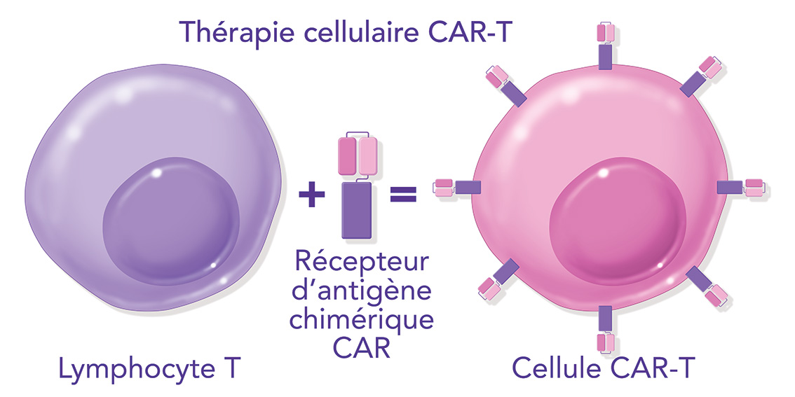 Car T Cells Et Cancer: Cellule Car T Définition – FPYK